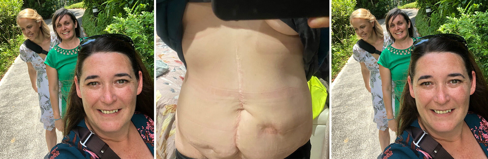 Amanda C's story - Bowel Cancer Australia